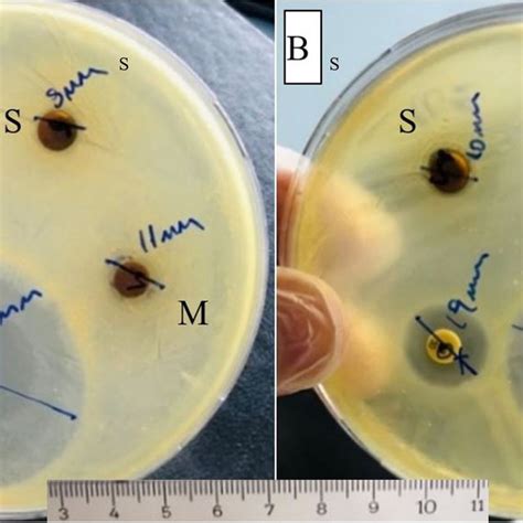 Antibiogram Test Results Of Antibiotics And Phytochemicals Used In The