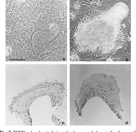Figure 1 From Modulation Of Human Epidermal Cell Response To 2378