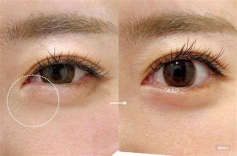 네이버 인플루언서