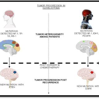 Tumor Progression Amongst Profiles In GBM Along With Heterogeneity Of Download Scientific