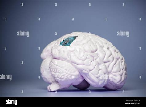 BCI Brain Computer Interface With Chip Embedded Stock Photo Alamy
