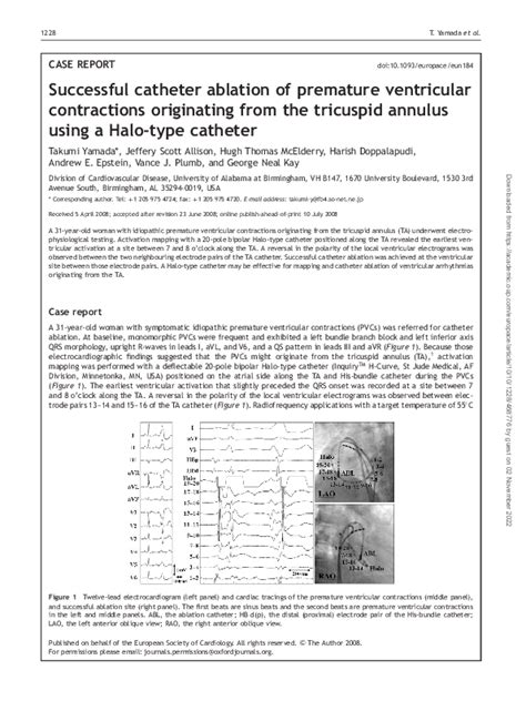 Pdf Successful Catheter Ablation Of Premature Ventricular
