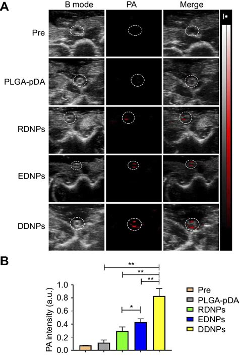 PA Molecular Imaging Notes A PAI Of Mixed Thrombus In The Abdominal Download Scientific