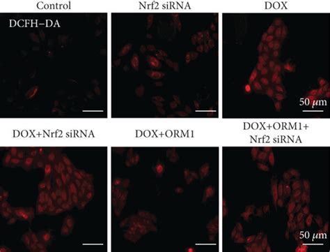 Nrf2 Knockdown Reverses The Protective Effects Of Orm1 In Doxorubicin Download Scientific