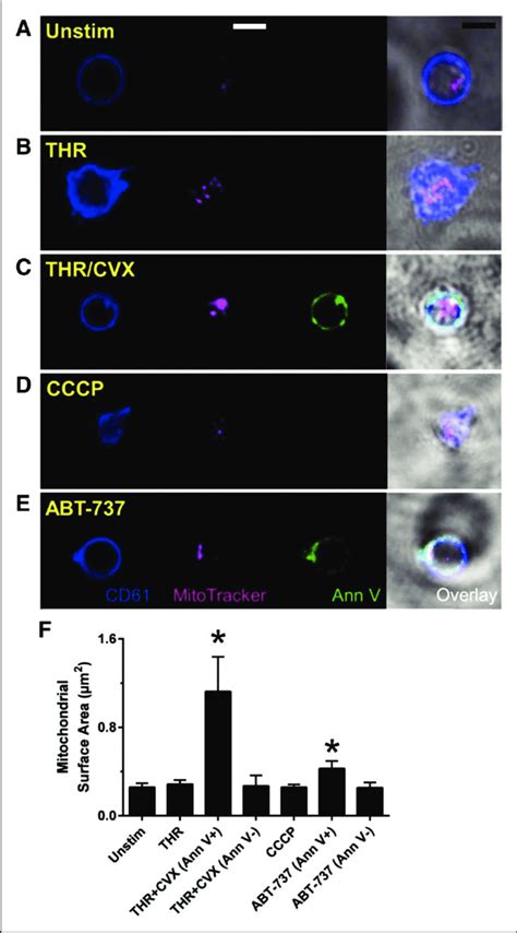 Mitochondrial Swelling In Apoptotic And Agoniststimulated Platelets Download Scientific
