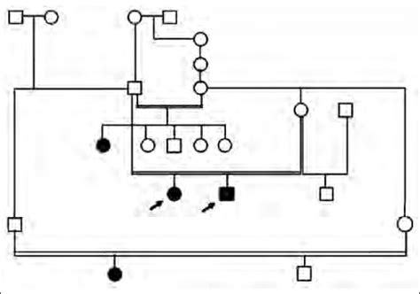 Naxos Disease In Two Siblings Abstract Europe Pmc