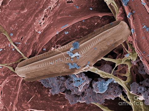 Diatom With Thermophilic Bacteria Photograph By Ted Kinsman Fine Art