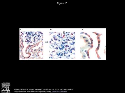 Differential Expression Of Adenylyl Cyclases In The Rat Nephron Ppt
