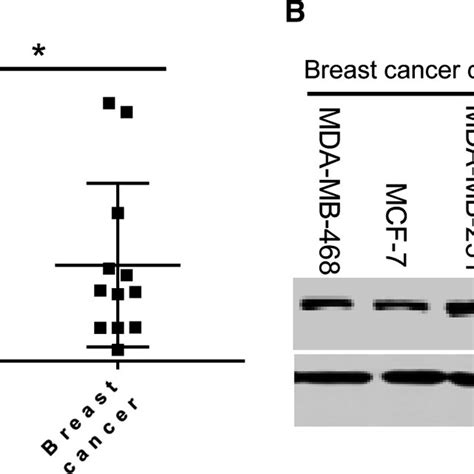 The Expression Levels Of Ghr In Breast Cancer Tissues And Cell Lines Download Scientific