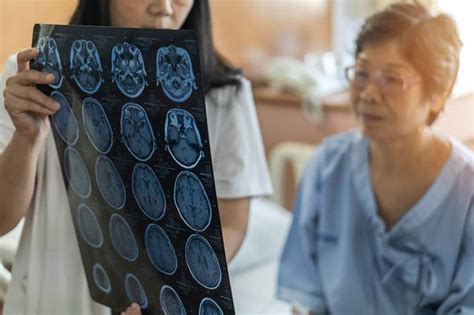 Cerebrovascular Disease Symptoms Common Signs Of Brain Conditions