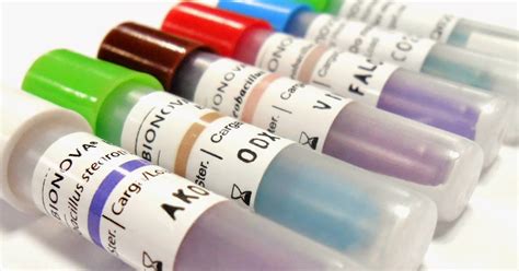 ตัวบ่งชี้ทางชีวภาพ Biological Indicator