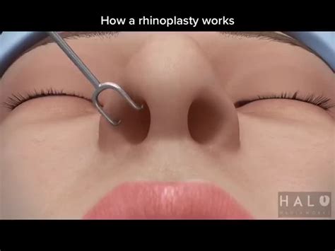 [video] Mohamed El Shazly On Linkedin Surgery Job Science Media