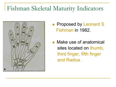 Skeletal Maturity Indicator Ppt