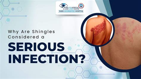 The Hidden Dangers Of Shingles What You Need To Know