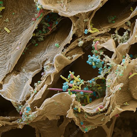 Sauerkraut Bacteria Sem Stock Image C049 1719 Science Photo Library