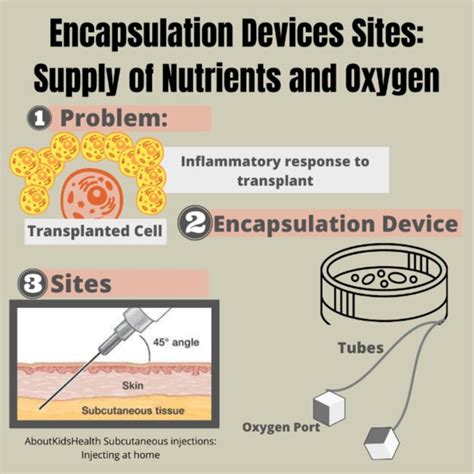 Macroencapsulation Vs Microencapsulation Download Scientific Diagram