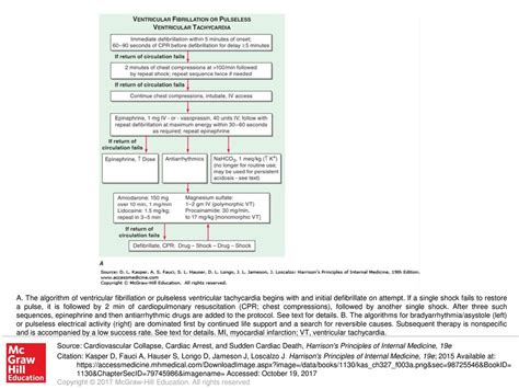 Ventricular Fibrillation Algorithm