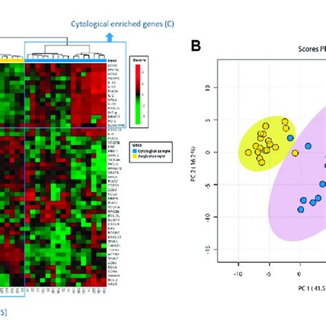 Stromal Genes From Pdac Are Differently Expressed In Eus Fna And