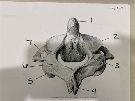 Axis C2 Diagram Quizlet