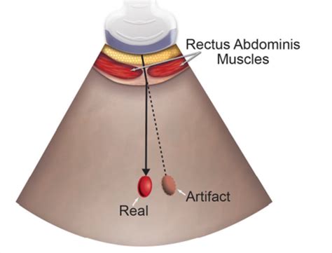 Solved What Kind Of Artifact Does The Associated Drawing