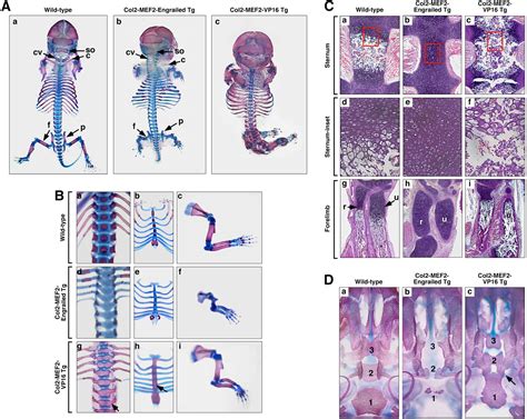 Chondrocyte Hypertrophy Semantic Scholar