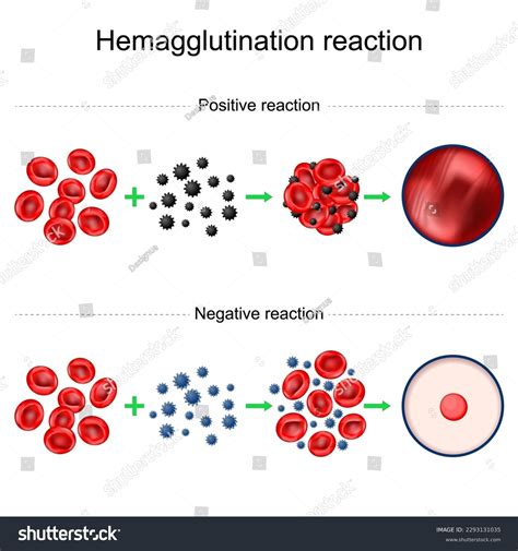 Positive Agglutination Test