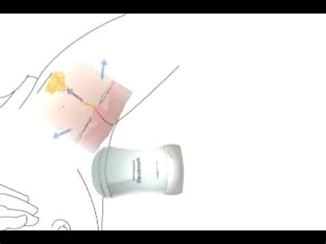 Lump In Armpit Video Its Educational YouTube