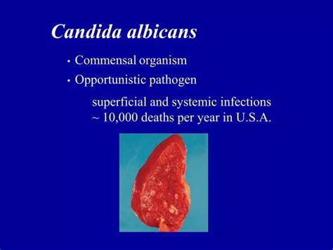 Ppt Opportunistic Pathogen Powerpoint Presentation Free Download