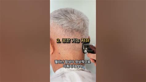 갑자기 흰머리가 많이 생긴다면 의심해볼 질환 4가지 흰머리 새치 건강관리 건강꿀팁 건강정보 Youtube