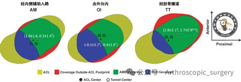 【手术技术】前交叉韧带重建中怎么样能精准的定位股骨隧道？ 好医术文章 好医术 赋能医生守护生命