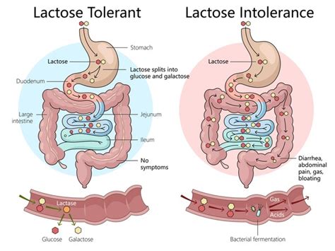 Categoría Digestive Tolerance De Imágenes Fotos De Stock E Ilustraciones Libres De Regalías