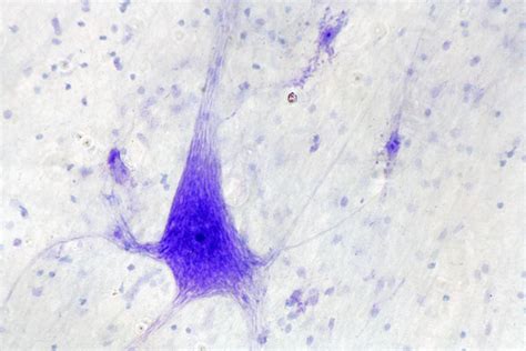 Multipolar Neuron Under Microscope