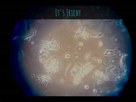 Trichomoniasis Microscope