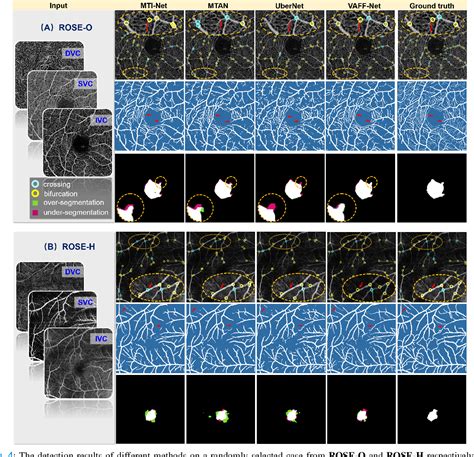 Retinal Structure Detection In OCTA Image Via Voting Based Multi Task Learning