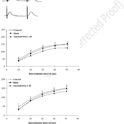 The Hippocampal Trisynaptic Circuit Based On Extensive Anatomical And