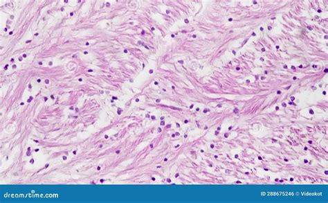 Section Of Human Sensory Cortex Filmed Under Microscope 400x On Bright