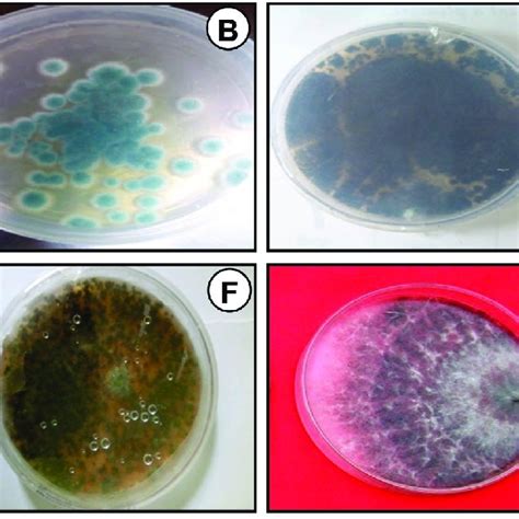 Different Types O F Microfungi Isolates From Healthy And Diseased