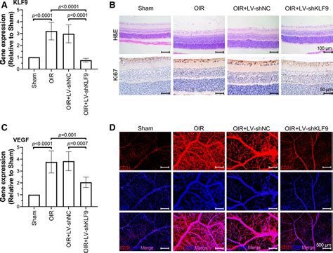 Knockdown Of Klf9 Inhibits Retinal Angiogenesis And Mitigates Pdr In