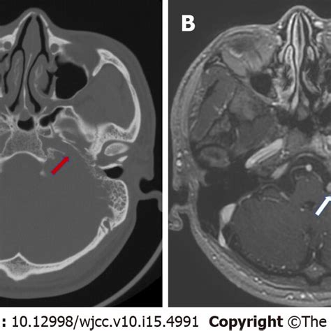 Preoperative Computed Tomography And Magnetic Resonance Imaging Images