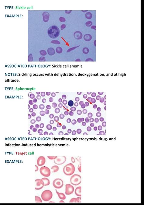 Hematology And Oncologies NEET PG MedicalTalk Net The Best
