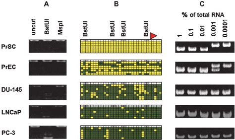 Promoter Methylation And Rassf1a Expression In Prostate Normal And