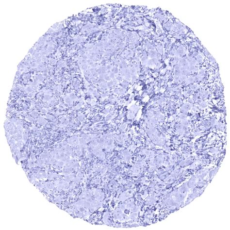 Cancer Tissue Gallery Gtx04380 Genetex