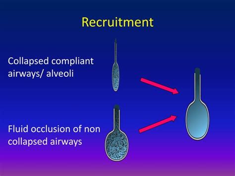 Pv Curve And Lung Recruitment Pptx Lung And Respiratory Health Diseases And Conditions