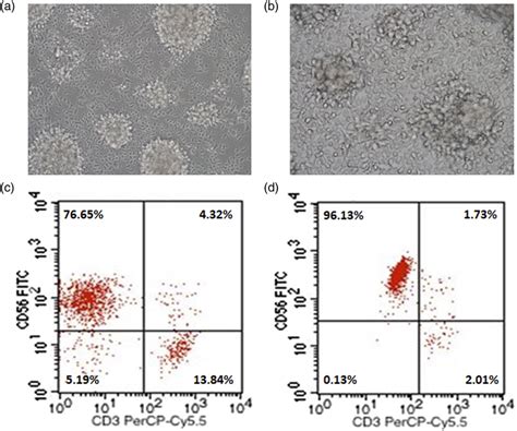 Morphological Characteristics And Phenotypic Identification Of Nk Cells