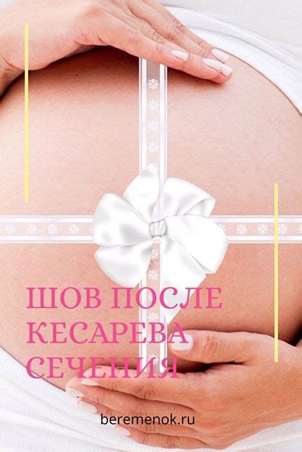 Шов после кесарева сечения в 2020 г Подготовка к родам Роды Советы