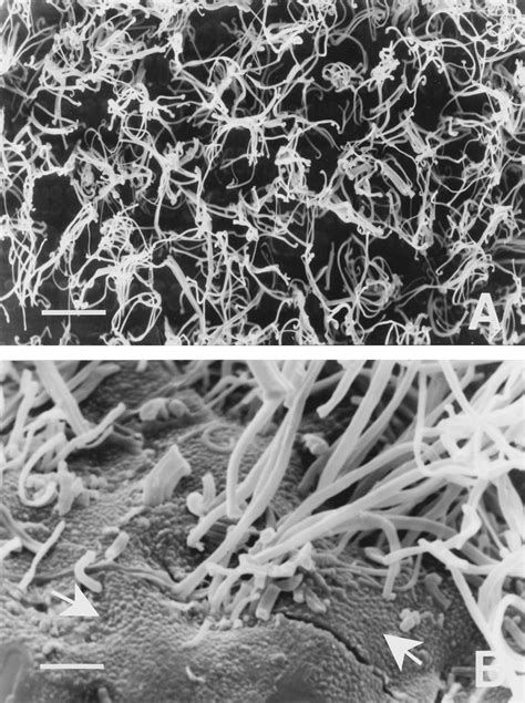 Scanning Electron Micrographs Showing Microscopic Surface Morphology Of