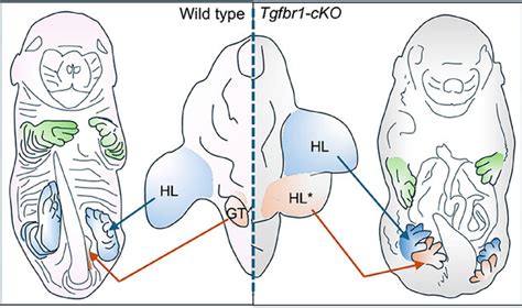 The Link Between Tgf‐β Signaling And Chromatin Dynamics Takes An