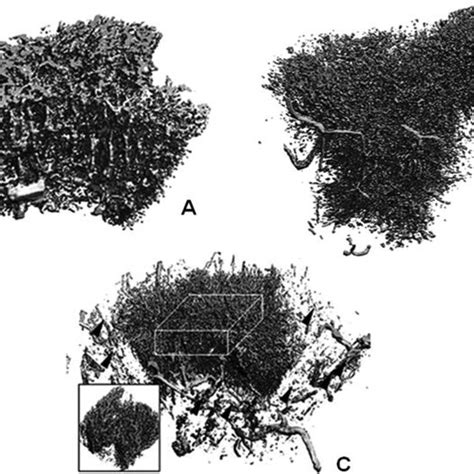 Three Dimensional Vessel Imaging Of Tibia Metaphysis Using Conventional Download Scientific