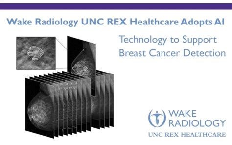 Wake Radiology UNC REX Healthcare Introduces Profound AI Wake Radiology