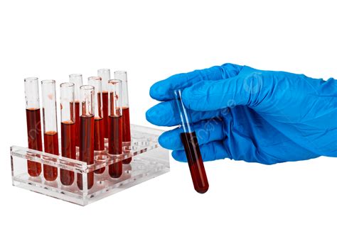 Provetta Per Donazione Di Sangue Donazione Di Sangue Sangue Sangue Prelievo Immagine PNG E